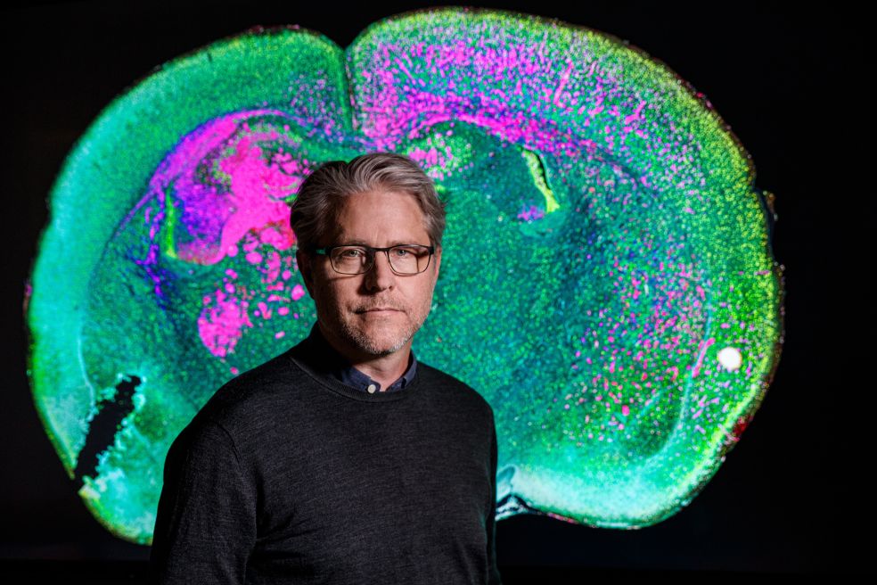 Mapping aggressive brain tumors in search of a cure | Knut and Alice ...