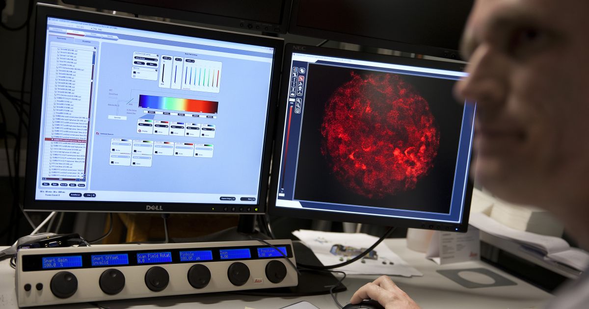 The eye as a body window to diabetes | Knut and Alice Wallenberg Foundation
